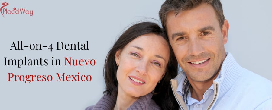 All on 4 Dental Implants in Nuevo Progreso Mexico