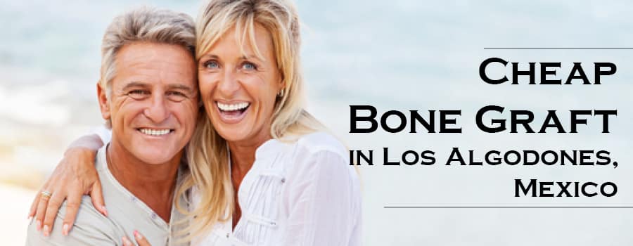 Bone Graft in Los Algodones Mexico - Cost starting from $200
